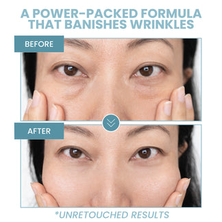 Matrixyl 3000 Serum Eye Gel - 2 oz – Eva Naturals