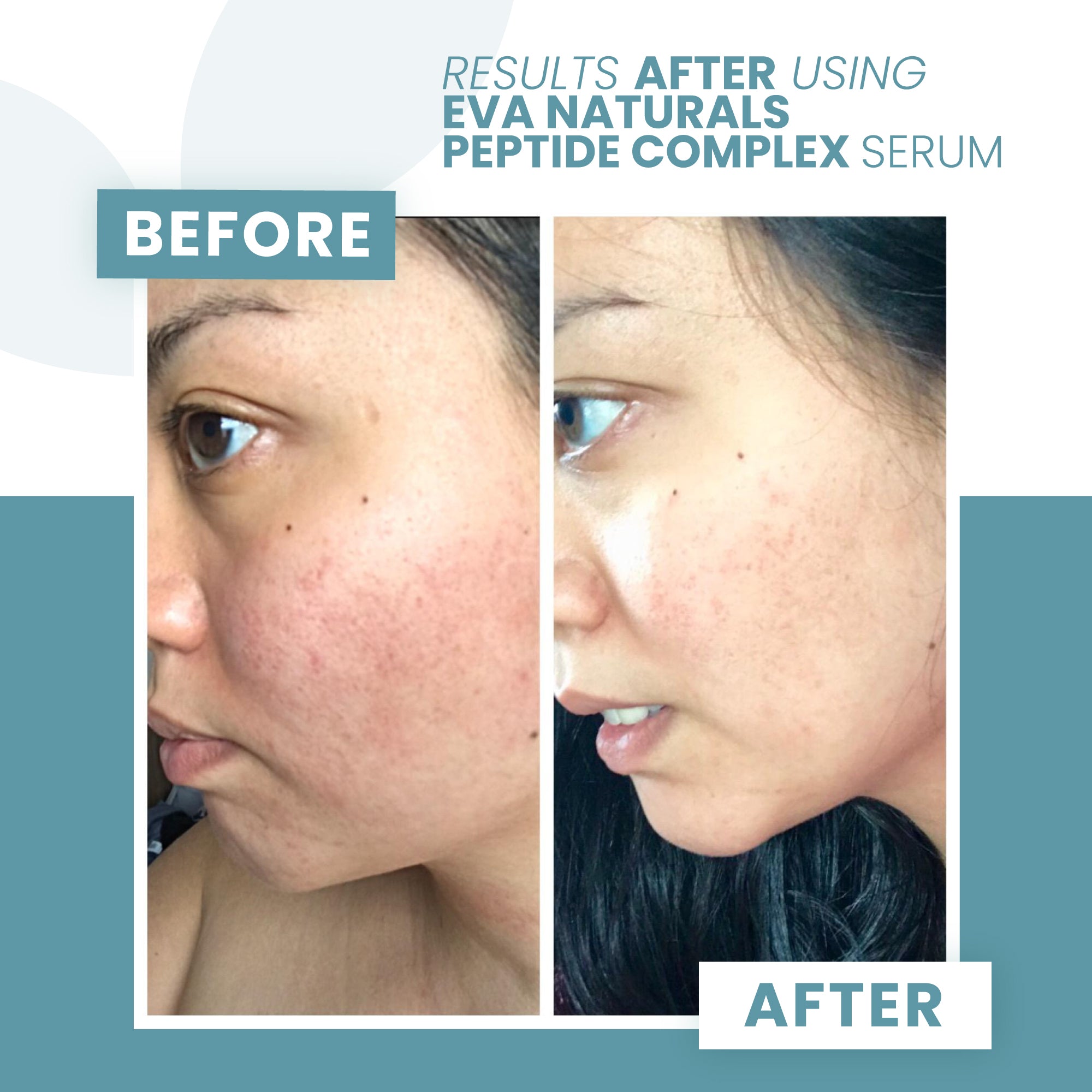 Skin Serum - Peptide Complex Collagen Serum | Eva Naturals – Eva Naturals